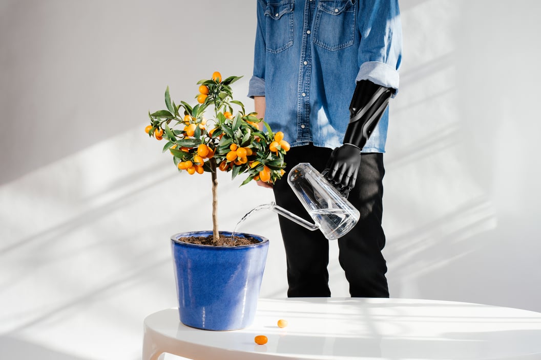 Components of a Bionic Arm Prosthesis - Aether Biomedical