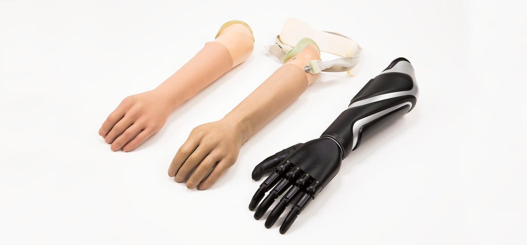 Components of a Bionic Arm Prosthesis - Aether Biomedical